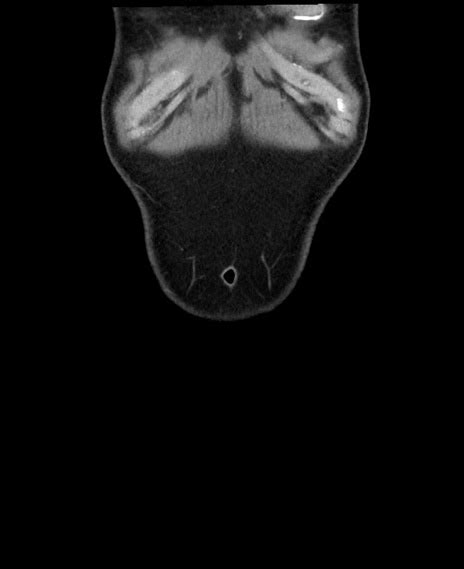 Tips Ct