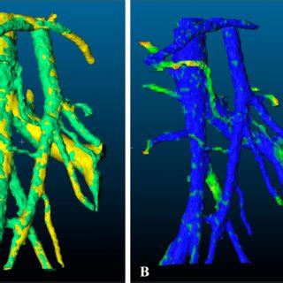 Quantitative Comparison Between Manually Segmented Models MSMs And