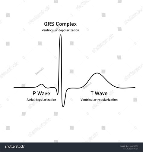 Ventricular Repolarization T Wave Qt Interval Stock Vector Royalty