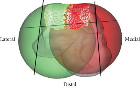 An Illustration Of The Model Reconstruction Process And 3d Fitting