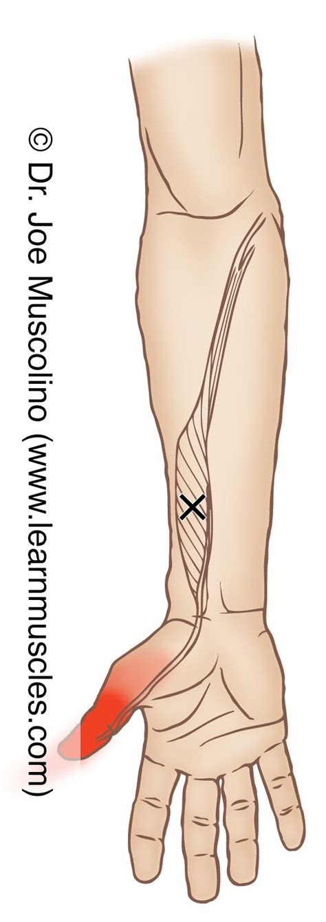Flexor Pollicis Longus Trigger Points Learn Muscles