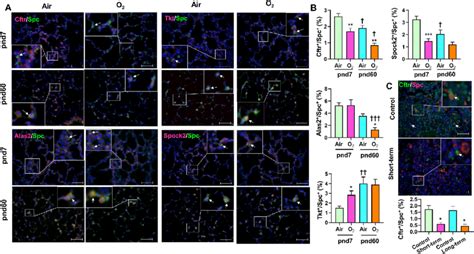Expression Of Alas2 Cftr Spock2 And Tkt In At2 Cells From Mice