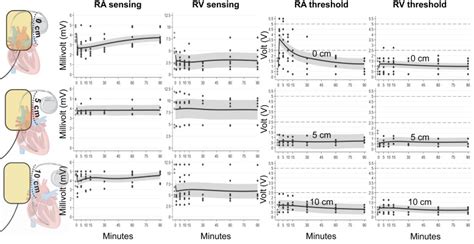 Pacemaker Performance After External Electrical Cardioversion With