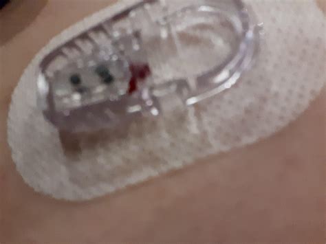 Sensor Bleeding Right After Pressing The Button Normal Fine Or Not