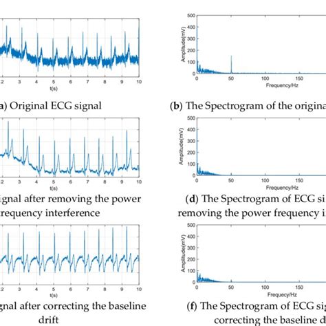 ECG Signals Before And After Filtering And Their Spectrograms Download Scientific Diagram
