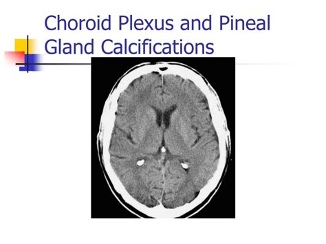 Ppt Ct Basics And Ct Brain Powerpoint Presentation Free Download Id 9501295
