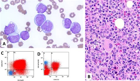 Aml With Myelodysplasia Related Gene Mutations Bcor Mutation Showing Download Scientific
