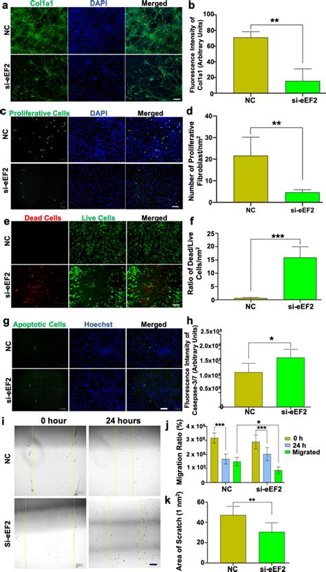 Eef2 Improves Dense Connective Tissue Repair And Healing Outcome By