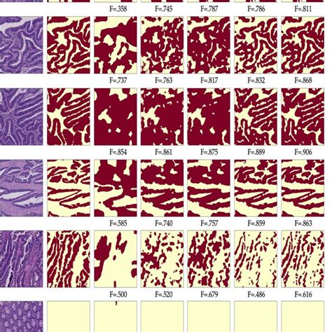 Segmentation Results On Dataset A A Input Images B Ground Truth