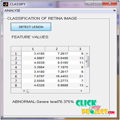 Automatic Assessment Of Macular Edema From Color Retinal Images