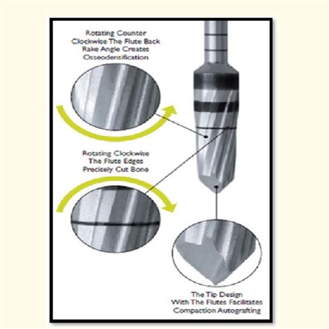 Pdf The New Bone Drilling Concept Osseodensification Hydrodynamic