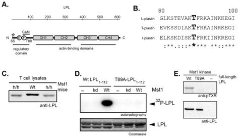 Mst1 Kinase Regulates The Actin Bundling Protein L Plastin To Promote T