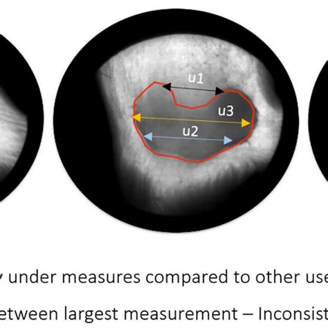Diagram Illustrating User Bias User 1 And Inconsistency Of Bias Download Scientific Diagram