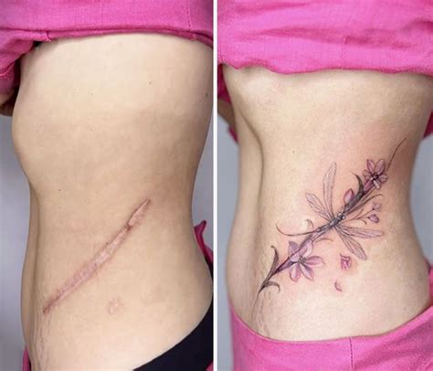 50 Times People Covered Up Their Scars With Adorable Tattoos Courtesy