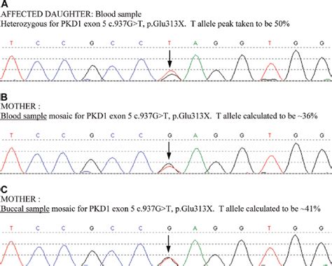 Reproduced Section From Nucleotides 931 943 Of Dna Sequence Analysis