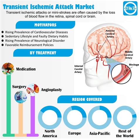Mini Stroke Symptoms Tia Transient Ischemic Attack Sy