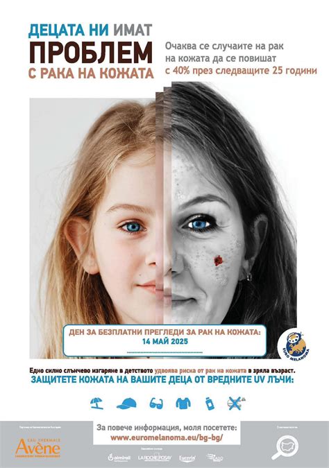 Euromelanoma Bulgaria Девет от всеки 10 случая на рак на кожата се причиняват от