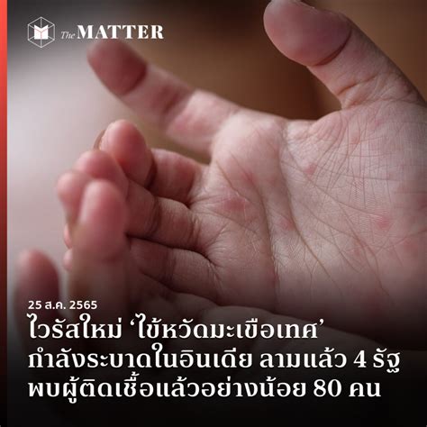 ไวรัสใหม่ ‘ไข้หวัดมะเขือเทศ กำลังระบาดในอินเดีย ลามแล้วใน 4 รัฐ พบผู้