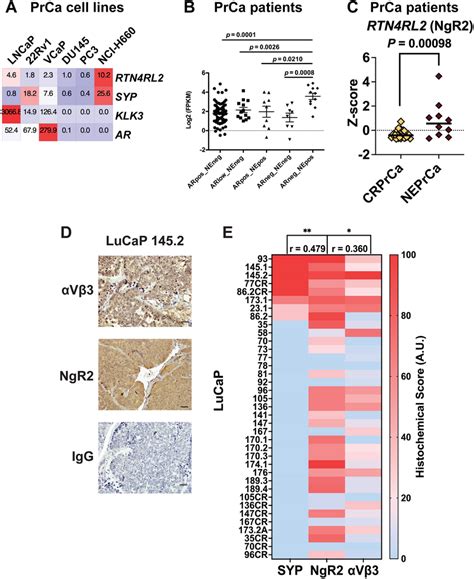 Ngr2 Expression Is Increased In Neprca Patients Ne Cell Lines And
