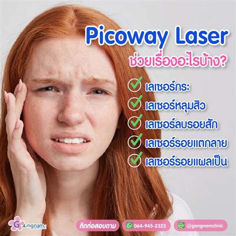 รู้จักกับเครื่อง Picoway Laser คืออะไร ได้ผลดีกับแก้ปัญหาเรื่องอะไรบ้าง