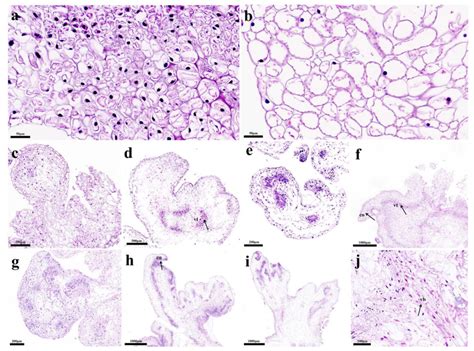 Histological Observation Of ‘fengdan Somatic Cell Embryos At Different