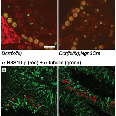 Defects In Late Spermiogenesis A Phase Contrast Microscopy Of Download Scientific Diagram