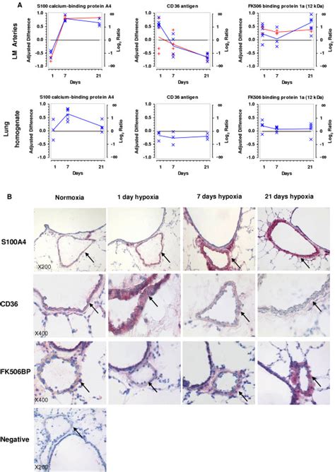 Regulation Of S100a4 Cd36 And Fkbp1a On Mrna And Protein Level