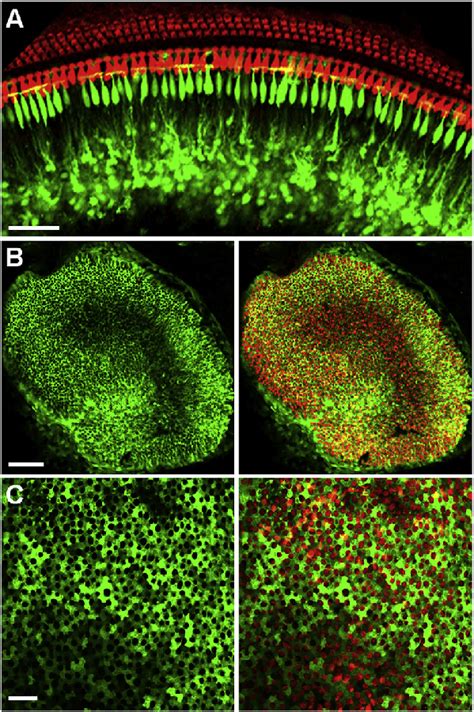 GFP Fluorescence With A Gfap Promoter Representative Confocal Images