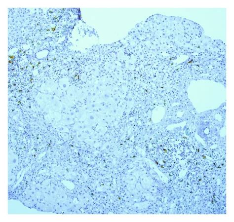 Representative Microphotographs Of Cd20 Marker By Immunohistochemistry