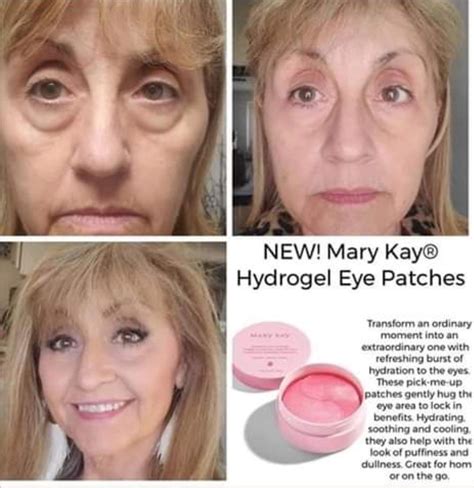 Hydrogel Patches By Mary Kay Take Years Off And Be Gentle On Your Skin