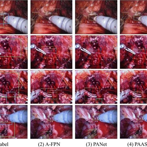 Path Aggregation Adaptive Spatial Network Download Scientific Diagram