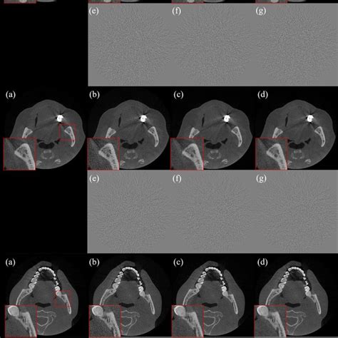 The Architecture Of U Net In Image Domain For Sparse View Ct Download Scientific Diagram