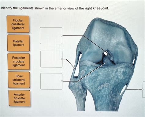 Identify The Ligaments Shown In The Anterior View Of The Right Knee