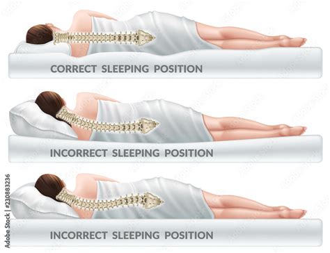 Correct And Incorrect Sleeping Poses Right And Wrong Position Spine On