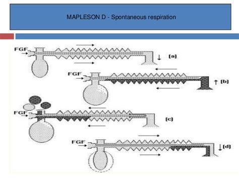 Mapleson System