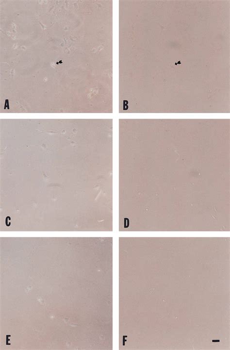Controls For Lipid Mediated Transfection Of Individual Neuronal Download Scientific Diagram