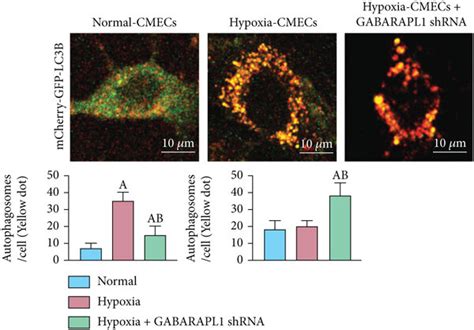 The Detection Of Mitochondrial Morphology Oxidative Stress Autophagy