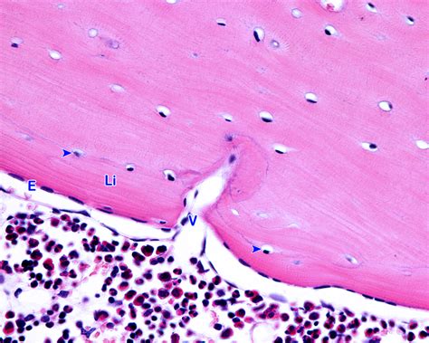 Microscopio De Osteocitos