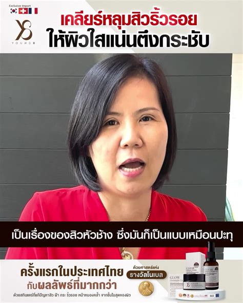 หลุมสิวตื้นขึ้นเยอะมากๆ จากสิวหัวช้างที่พร้อมปะทุ หลังจากที่ได้เจอ Y8