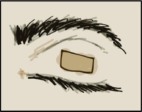 Ideal Positioning Of Blinkeze External Eyelid Weight Download