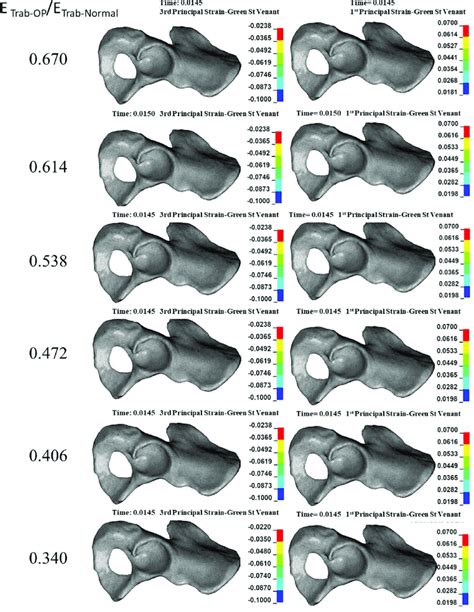 Effect Of Reduction In Trabecular Elastic Modulus E Trab On The