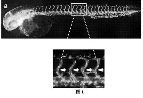 Application Of Gemfibrozil In Preparation Of Anti Angiogenic Medicaments Eureka Patsnap