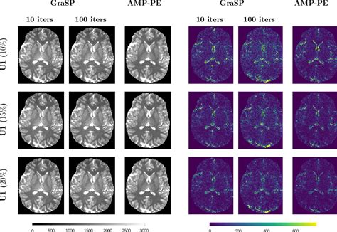 Figure 1 From Model Based T1 T2 And Proton Density Mapping Using A