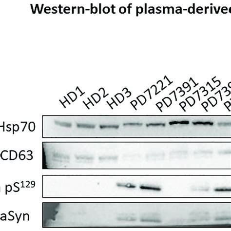 Western Blot Of Plasma Derived Evs Comparing Healthy Donors And Pd