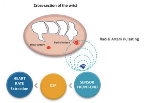 Rf Sensor Startup Teams With Switzerlands Csem