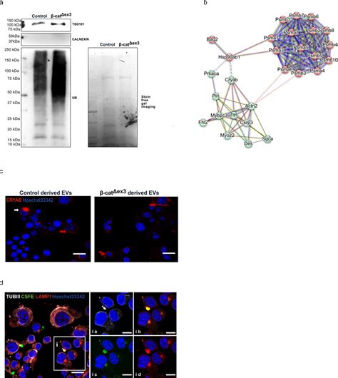 Ub Proteasomal Related Proteome Signature In Exosomes From β CatΔex3