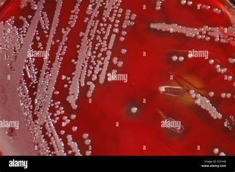 Agar Sangre De Oveja Fotografías E Imágenes De Alta Resolución Alamy