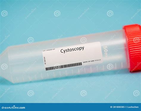Cystoscopy Stock Image Image Of Vaginal Camera Medical 281808385