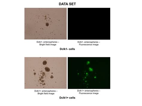 Pdf Dclk1 Small Intestinal Epithelial Tuft Cells Display The