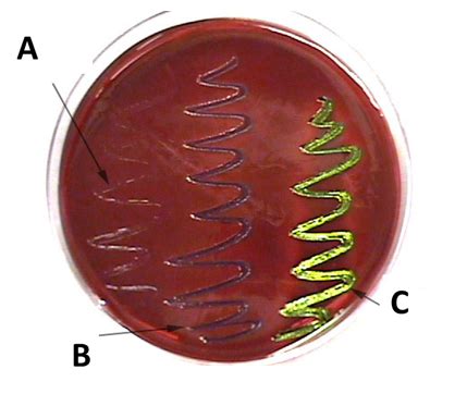BC2 Microbiology Bacterial Identification Lab Test Flashcards Quizlet